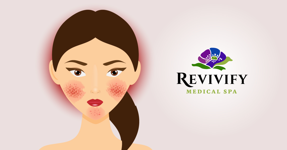 Medical Aesthetics - Revivify Medical Spa - Beaumont Texas - Contact Us ...